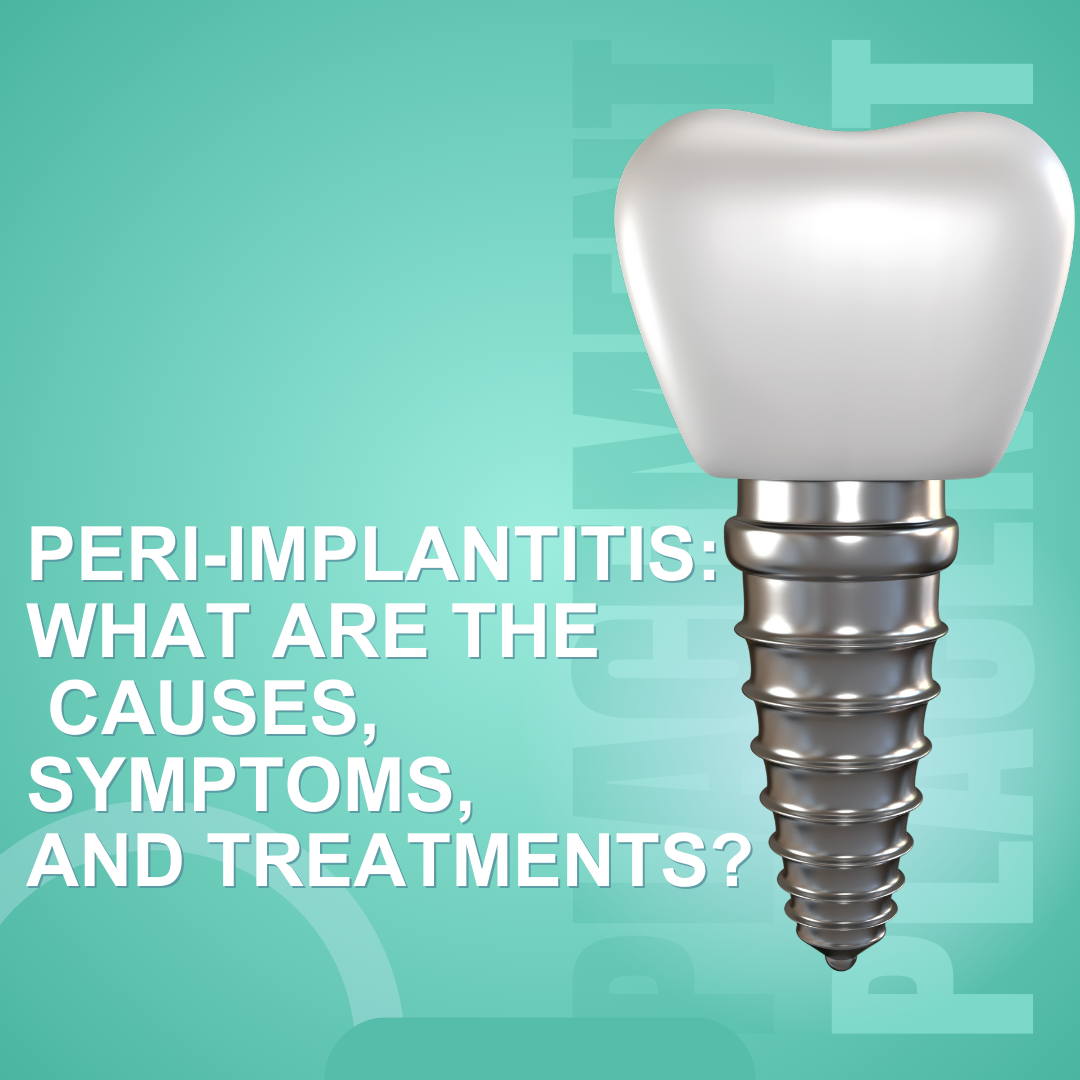 Peri-Implantitis: What are the Causes, Symptoms, and Treatments ...